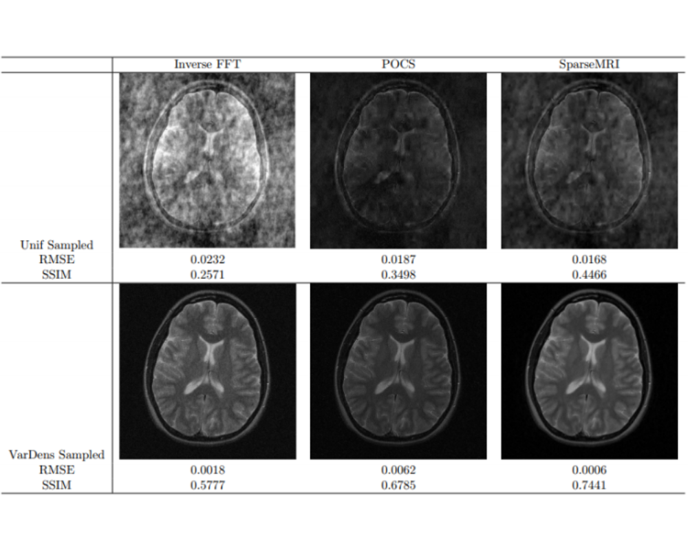 MRI Image Reconstruction from Undersampled K-Space data | Prakhar ...
